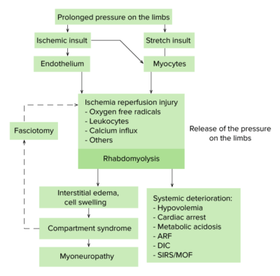 Síndrome de Esmagamento | Concise Medical Knowledge