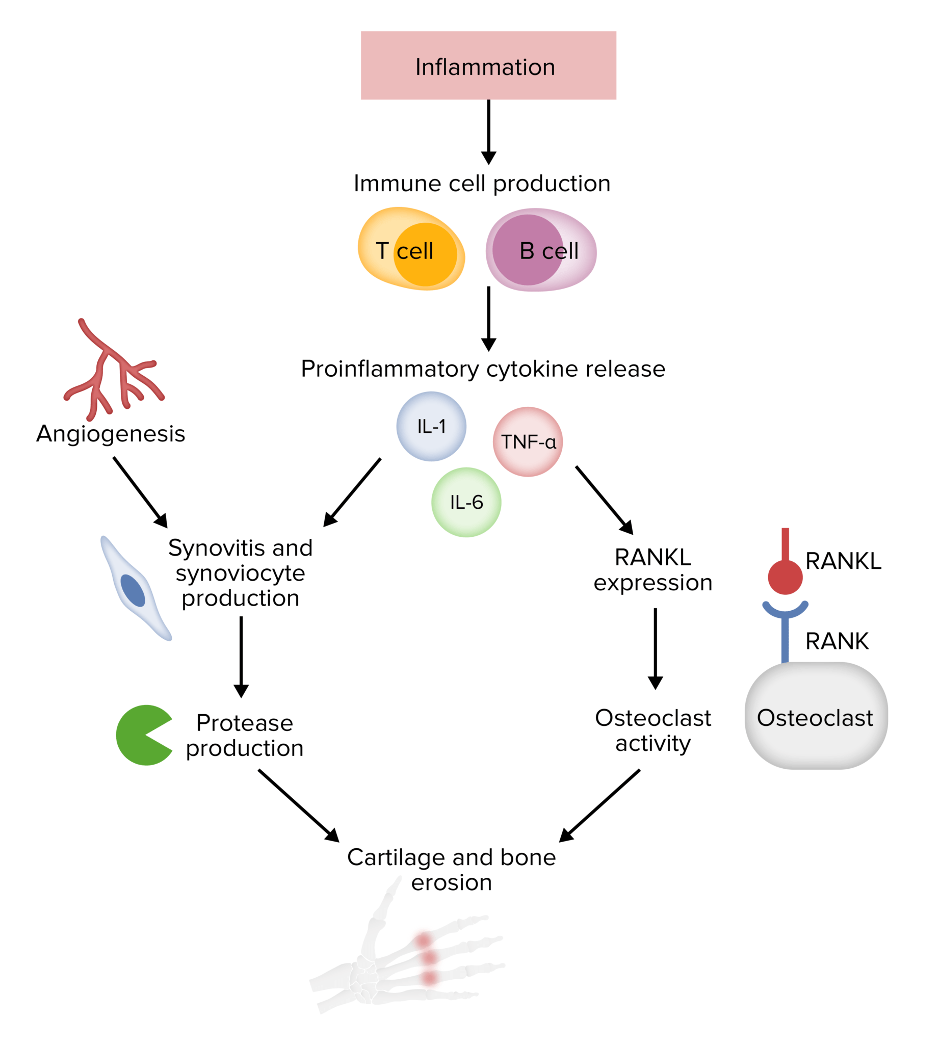 Rheumatoid Arthritis | Concise Medical Knowledge