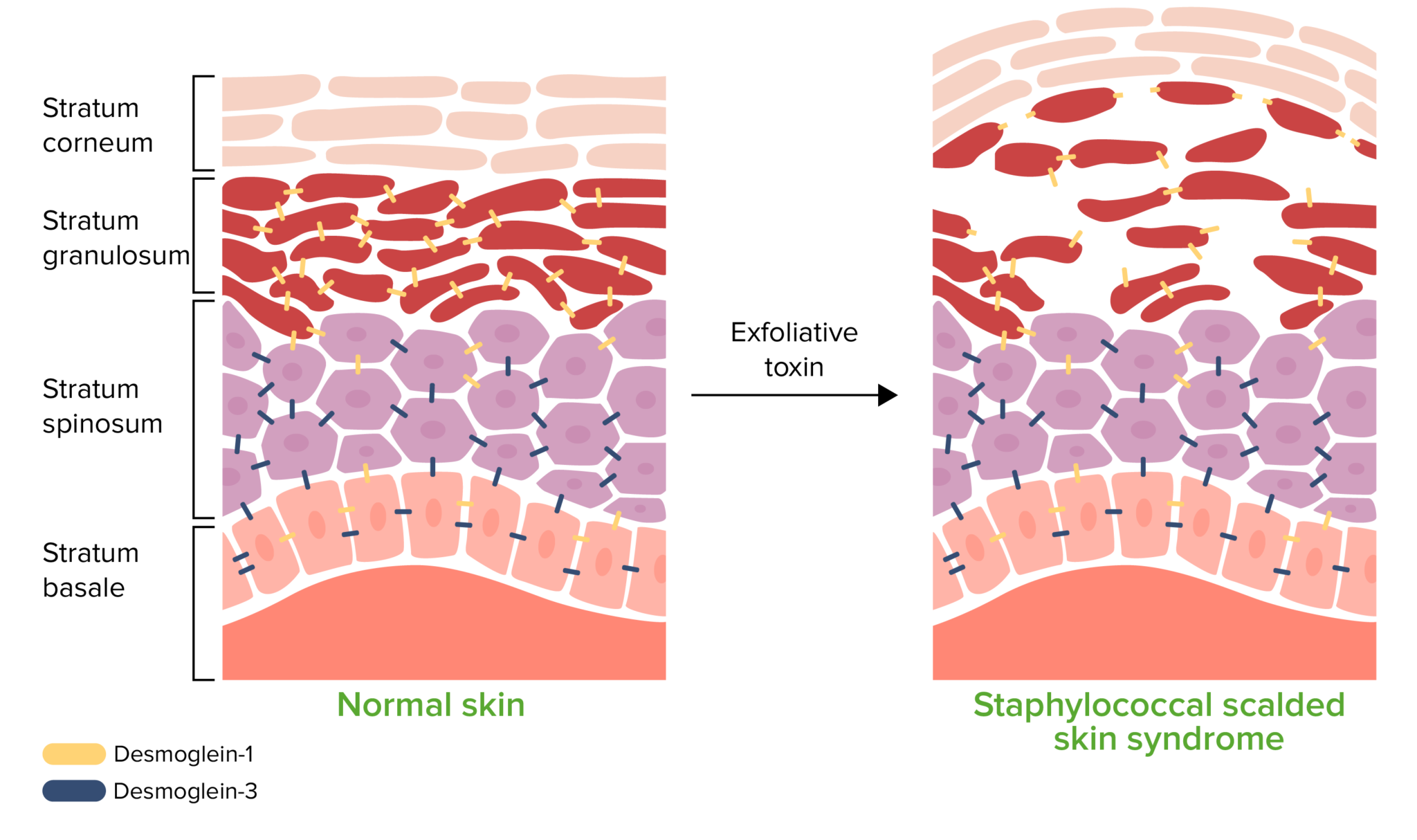 Staphylococcus | Concise Medical Knowledge