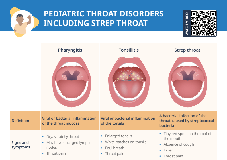 Strep vs Tonsillitis vs Pharyngitis | Lecturio Nursing