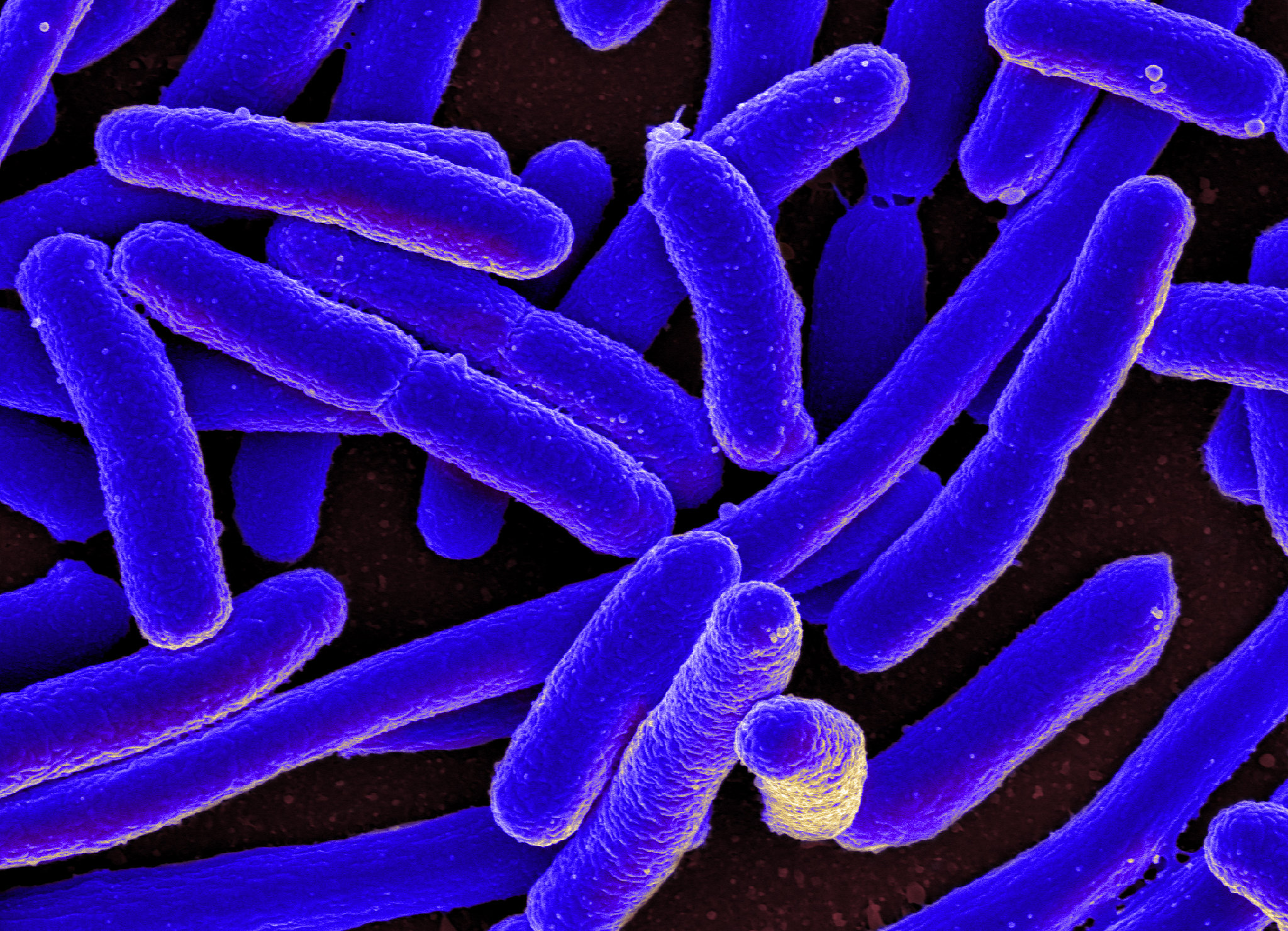 E Coli E Coli