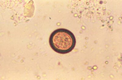 Taenia/Taeniasis | Concise Medical Knowledge