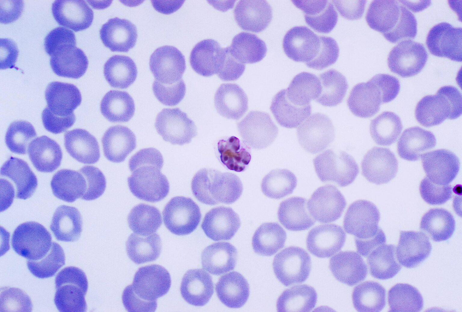 Plasmodium Malaria Concise Medical Knowledge
