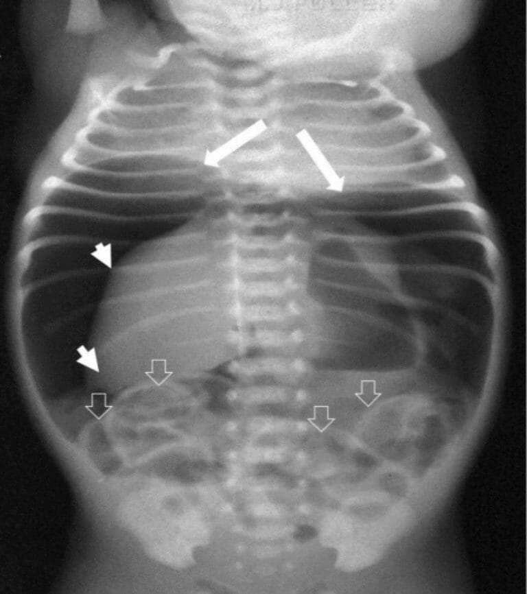 Imagem dos Intestinos | Concise Medical Knowledge