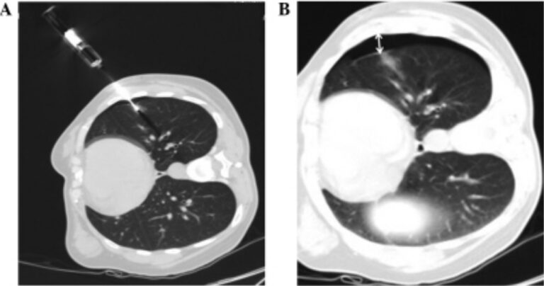 Imaging of the Lungs and Pleura | Concise Medical Knowledge