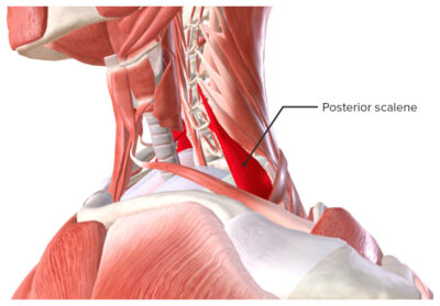 Neck Muscles: Anatomy & Groups | Concise Medical Knowledge
