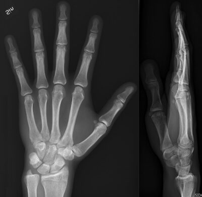 X-rays | Concise Medical Knowledge