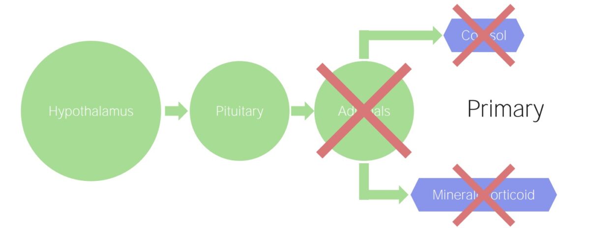 Adrenal Insufficiency and Addison Disease | Concise Medical Knowledge
