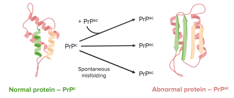 Transmissible Spongiform Encephalopathies | Concise Medical Knowledge
