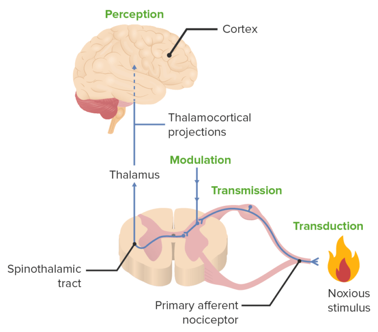 Pain Management | Concise Medical Knowledge