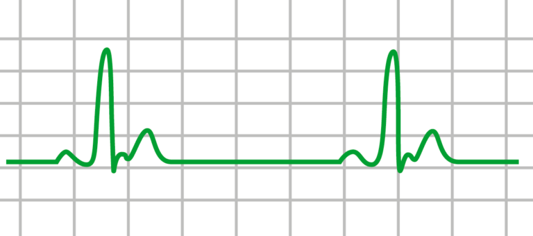 Paro Cardíaco | Concise Medical Knowledge