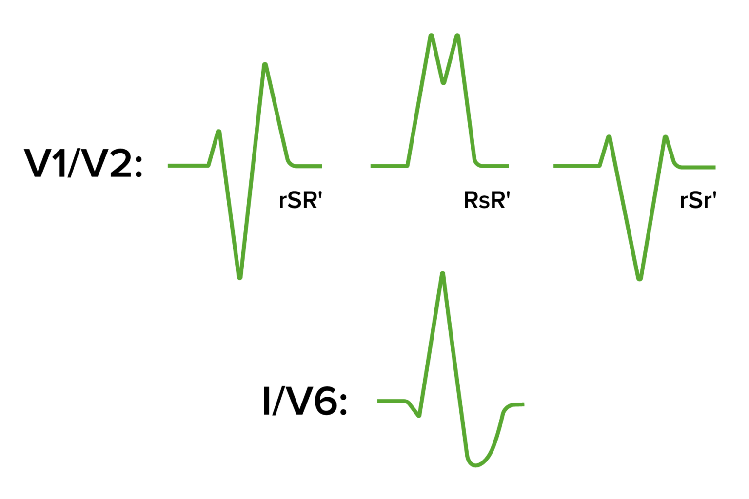 Bloqueios de Ramo e Fasciculares | Concise Medical Knowledge