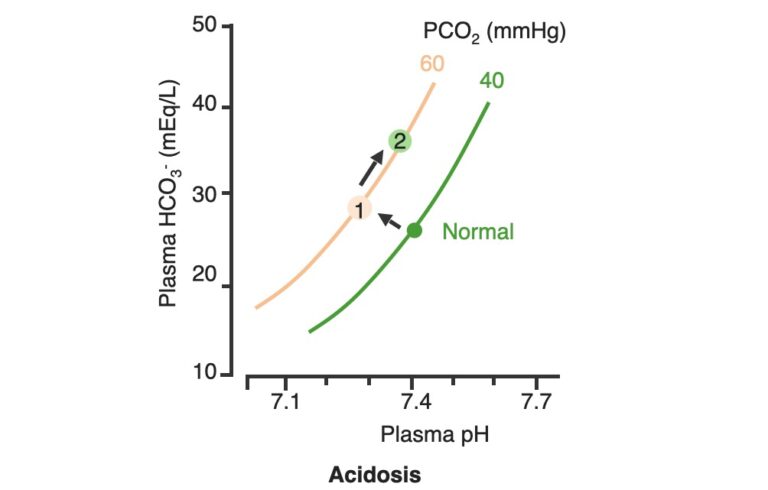 Respiratory Acidosis | Concise Medical Knowledge