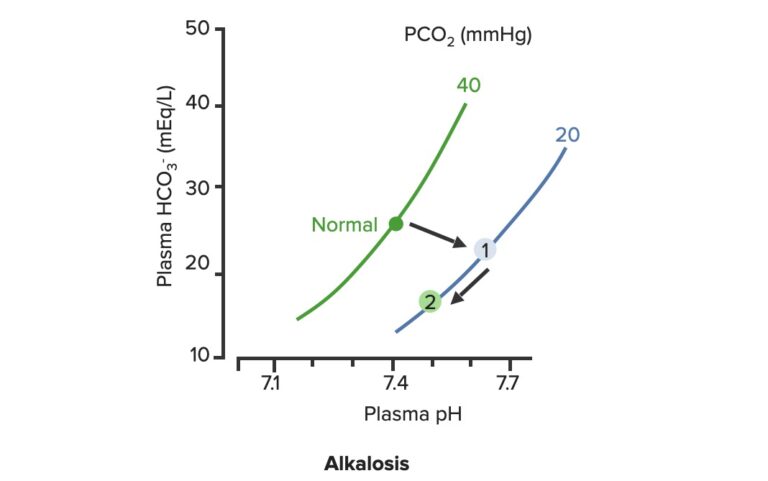 Respiratory Alkalosis | Concise Medical Knowledge