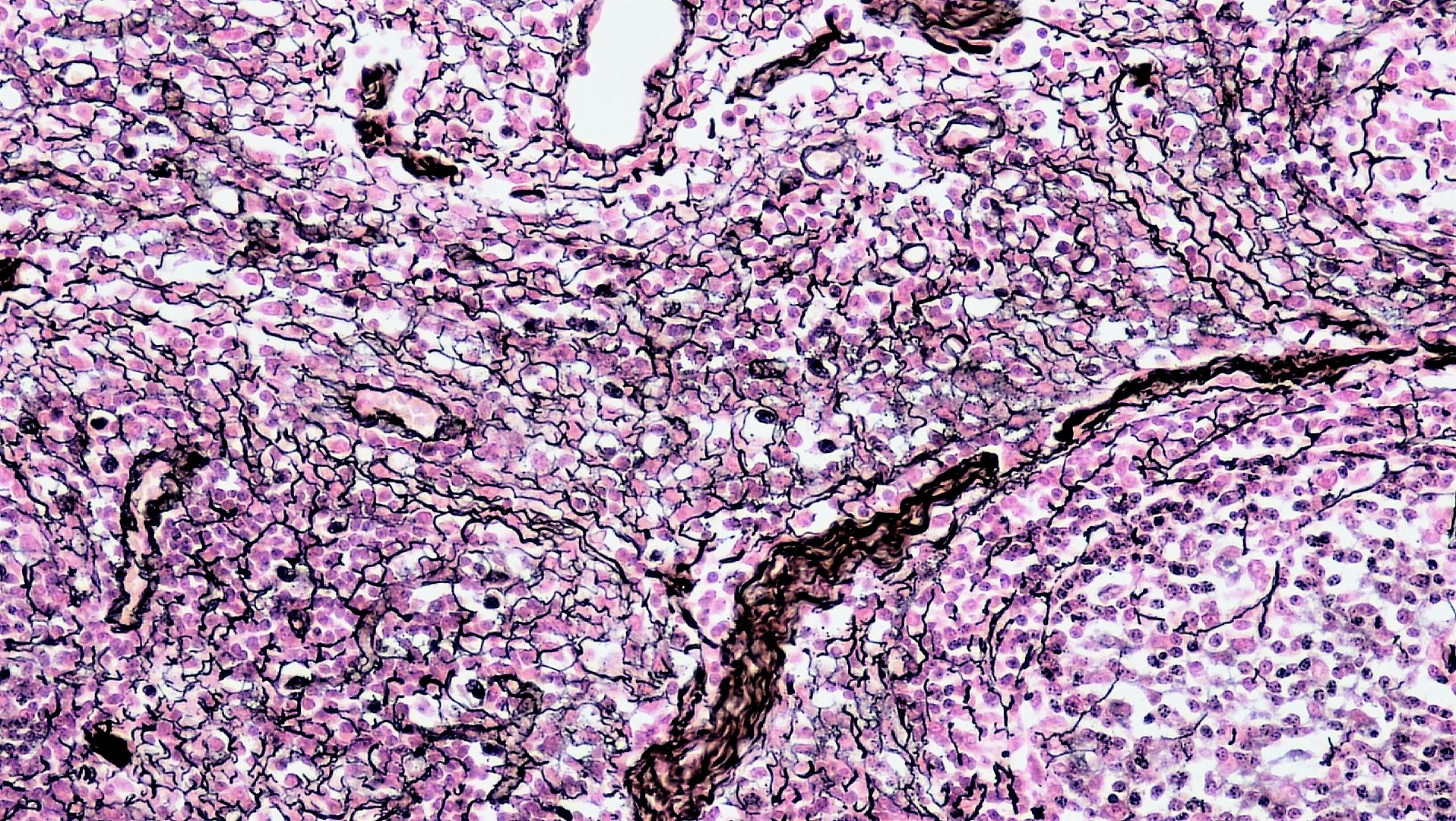 Connective Tissue Histology Concise Medical Knowledge