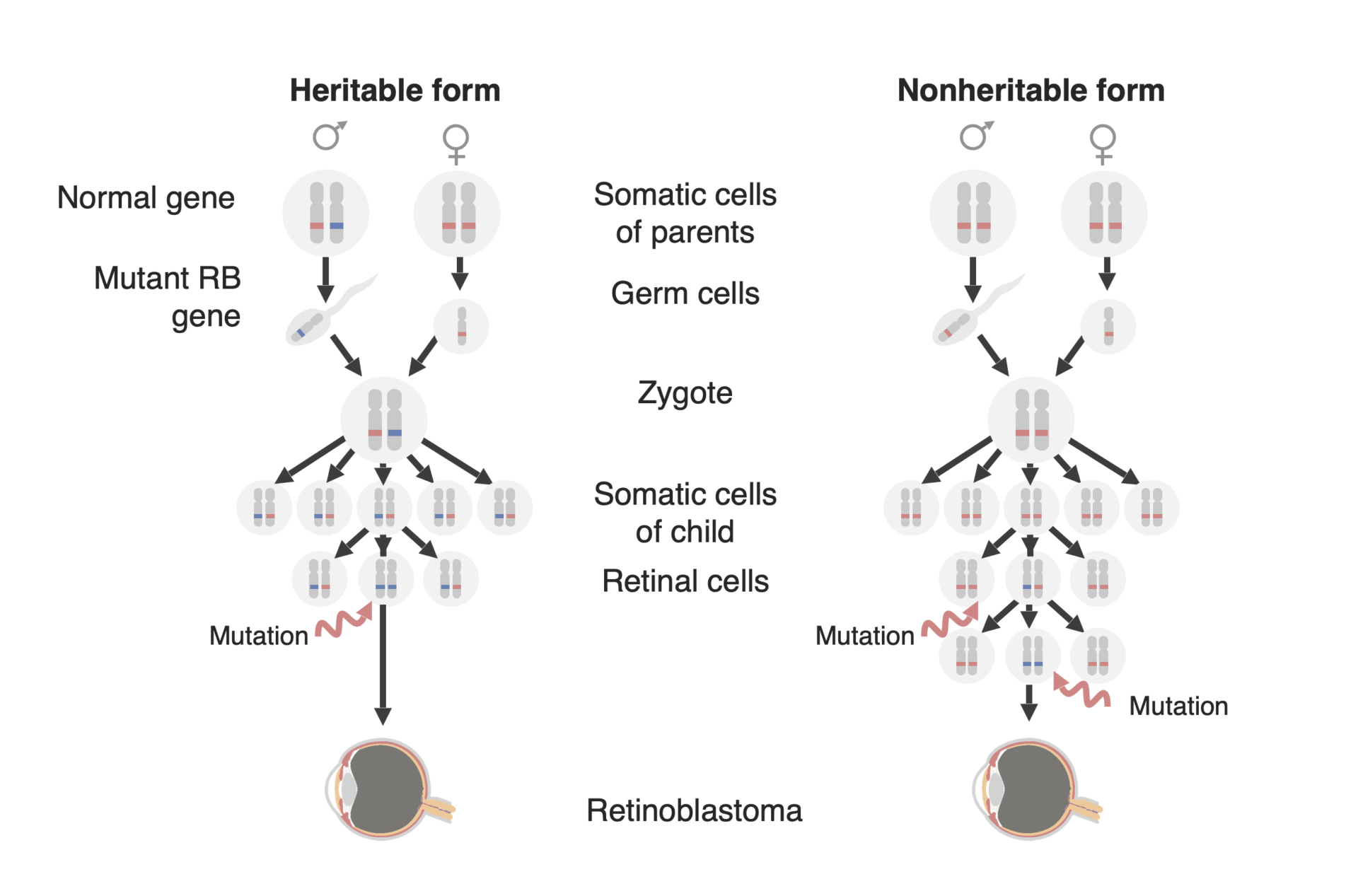 Retinoblastoma | Concise Medical Knowledge