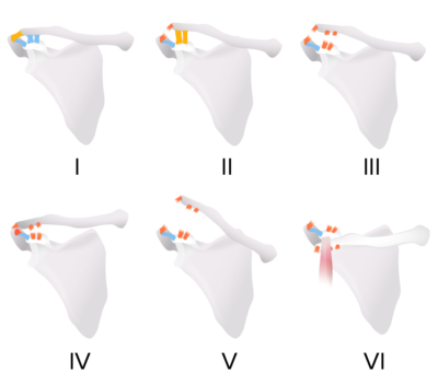 Acute Shoulder Pain | Concise Medical Knowledge