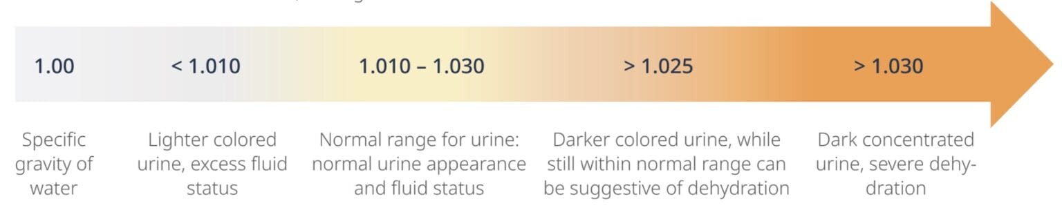 Specific Gravity Urine Test [+ Free Cheat Sheet] | Lecturio