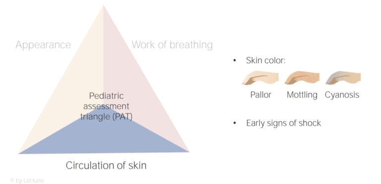 Pediatric Assessment Triangle | Lecturio Nursing