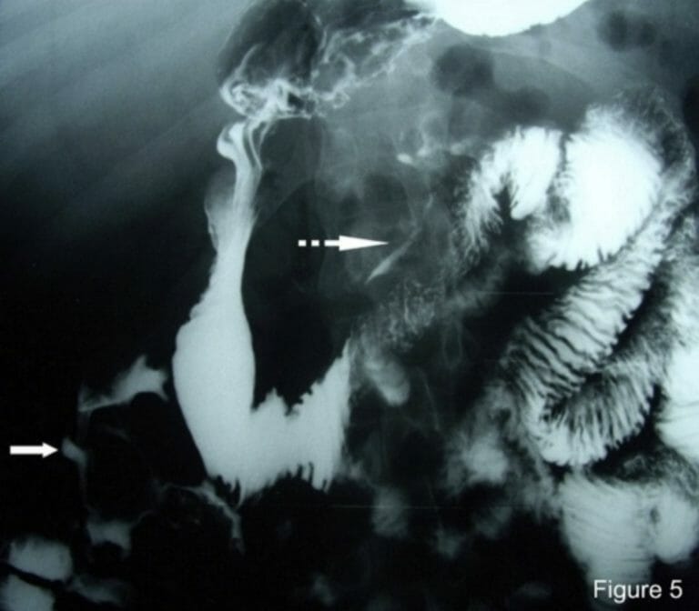 Imaging of the Intestines | Concise Medical Knowledge