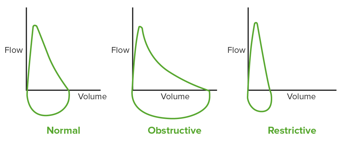 Pulmonary Function Tests Concise Medical Knowledge