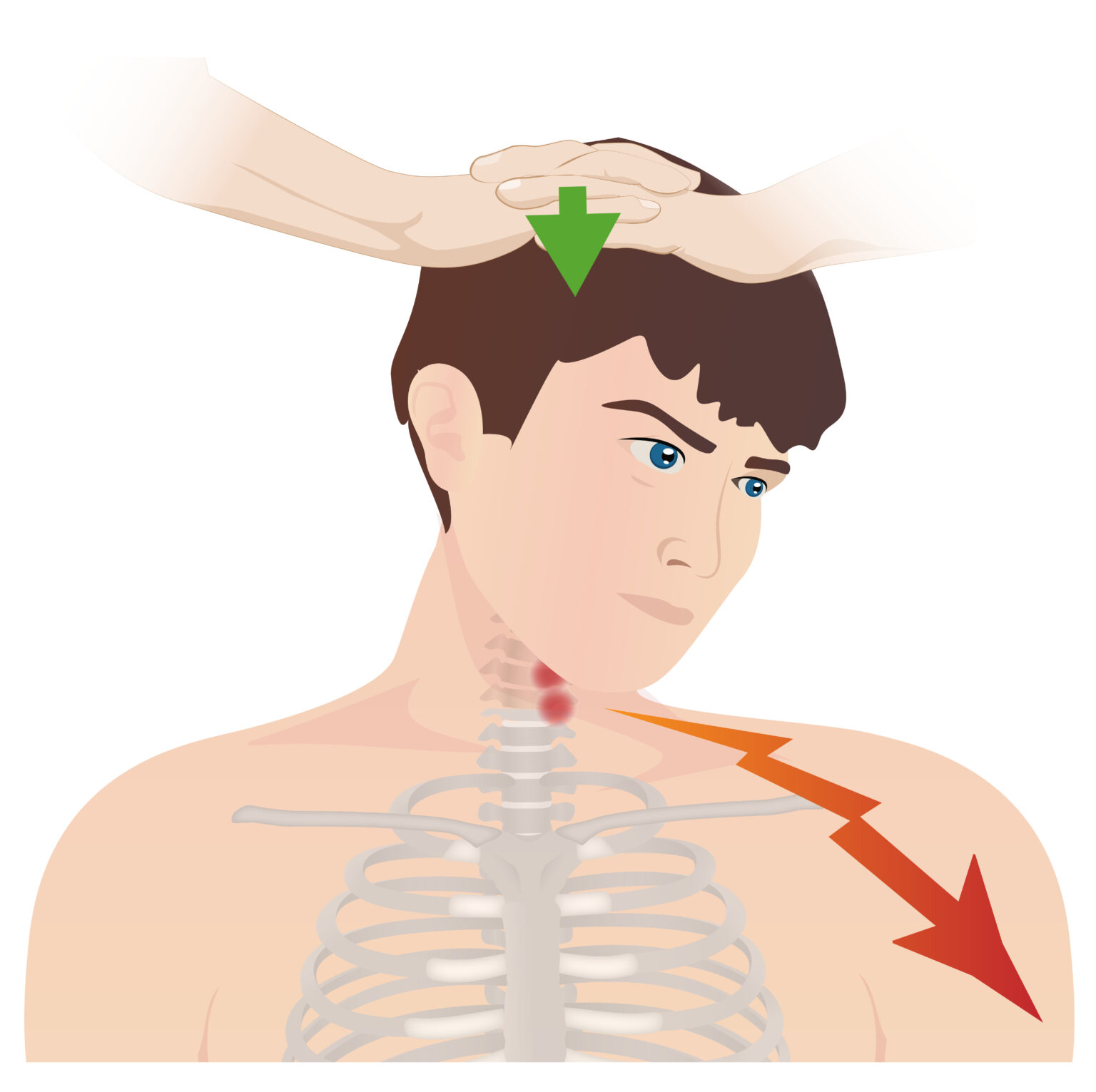 Neck Pain | Concise Medical Knowledge