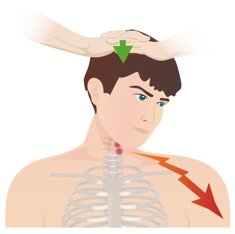 Neck Pain | Concise Medical Knowledge