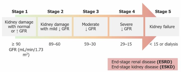 Doença Renal Crónica | Concise Medical Knowledge