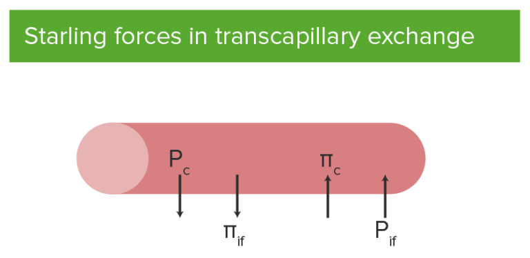 Pulmonary Edema | Concise Medical Knowledge