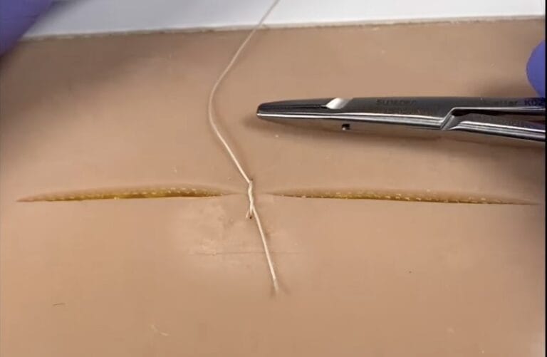 How to Stitch a Wound [Step-by-Step Guide] | Lecturio