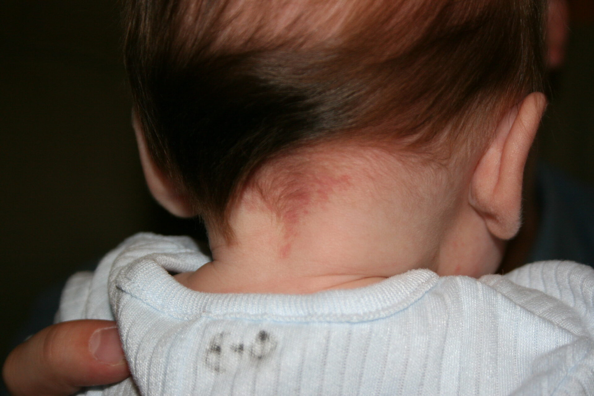 Physical Examination of the Newborn | Concise Medical Knowledge