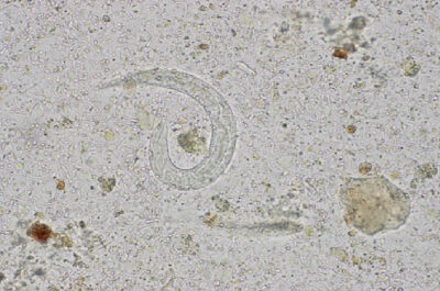 Strongyloidiasis | Concise Medical Knowledge