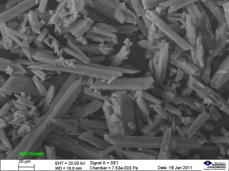 Nephrolithiasis | Concise Medical Knowledge