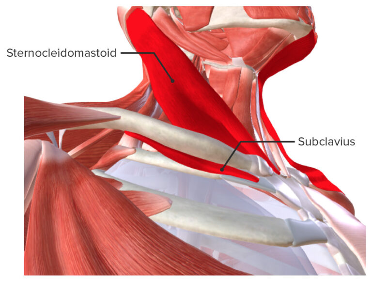 Músculos do Pescoço | Concise Medical Knowledge