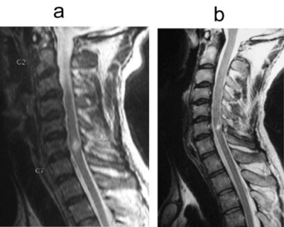 Magnetic Resonance Imaging (MRI) | Concise Medical Knowledge