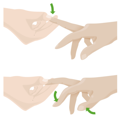 Neck Pain | Concise Medical Knowledge