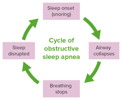 Obstructive Sleep Apnea | Concise Medical Knowledge