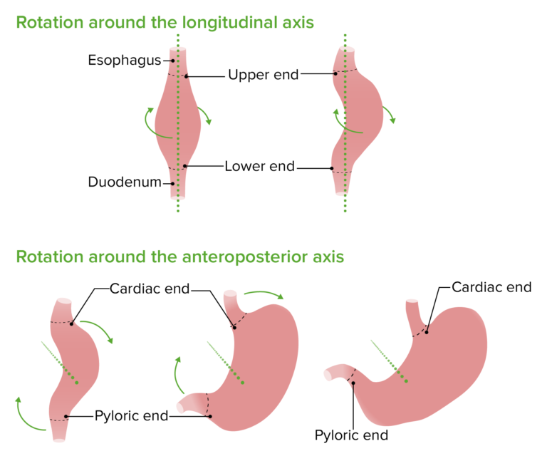 Development of the Abdominal Organs | Concise Medical Knowledge