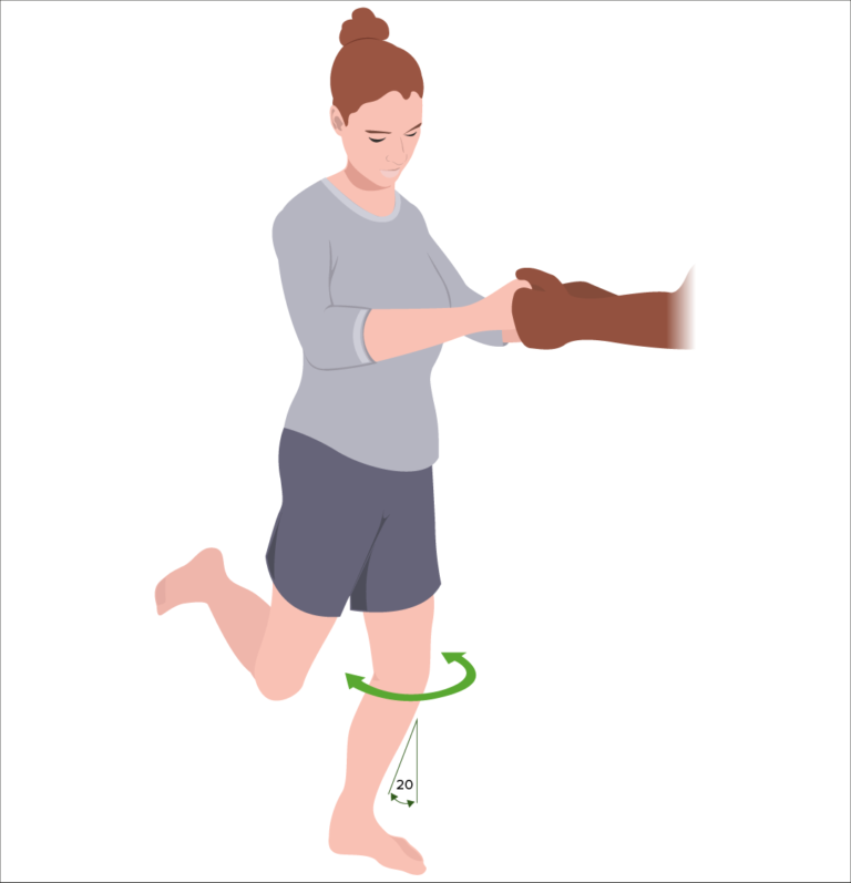 Meniscus Tear | Concise Medical Knowledge