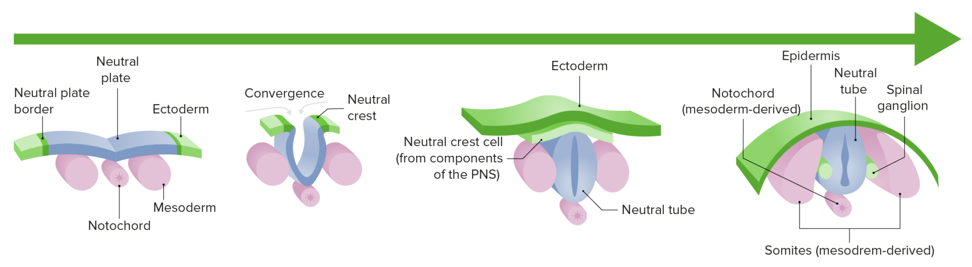 Neural Tube Defects | Concise Medical Knowledge