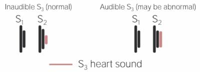 Heart Sounds | Concise Medical Knowledge