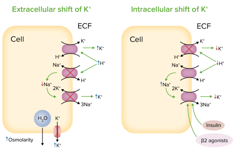 Hyperkalemia | Concise Medical Knowledge
