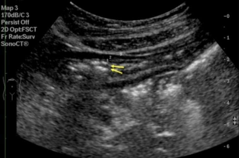 Imagenología Intestinal | Concise Medical Knowledge