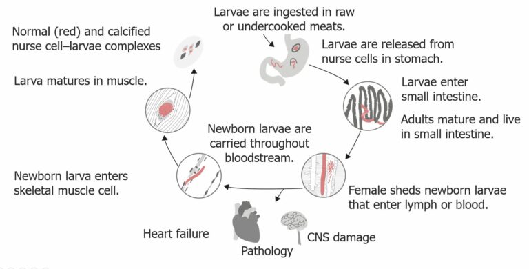 Trichinella/Trichinellosis | Concise Medical Knowledge