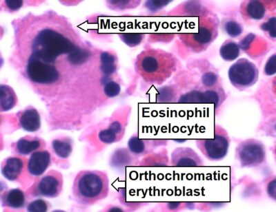 Bone Marrow: Composition and Hematopoiesis | Concise Medical Knowledge