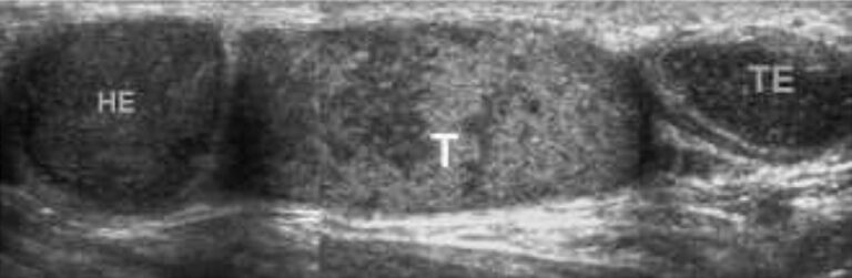 Scrotal Imaging Concise Medical Knowledge