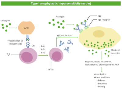Type I Hypersensitivity Reaction | Concise Medical Knowledge
