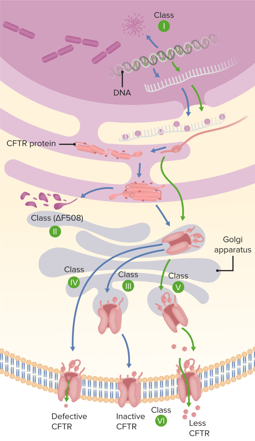 Cystic Fibrosis | Concise Medical Knowledge