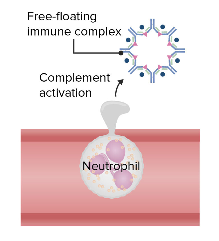 Type I Hypersensitivity Reaction | Concise Medical Knowledge