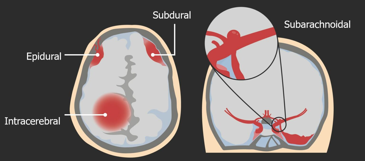 Imagenología de la Cabeza y el Cerebro | Concise Medical Knowledge